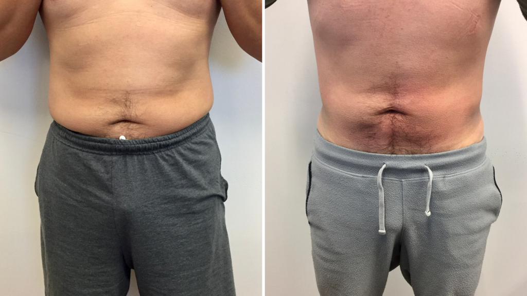 Testimonials and Before & After Photos | R3 Chattanooga